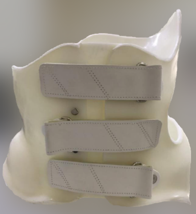 Orthotics - Motion Orthopedic