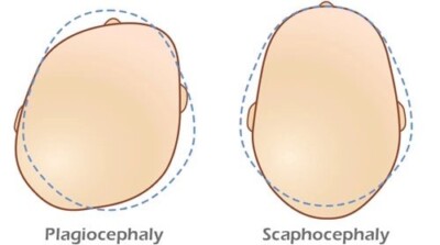Orthotics - Motion Orthopedic